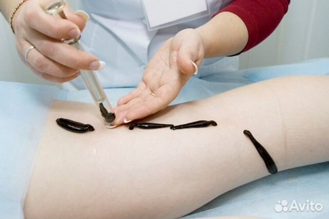 Пиявки оптом. Доставка по всей РФ и снг